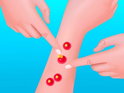 Pimple Poper Rush – Free Game | SuperKidGames